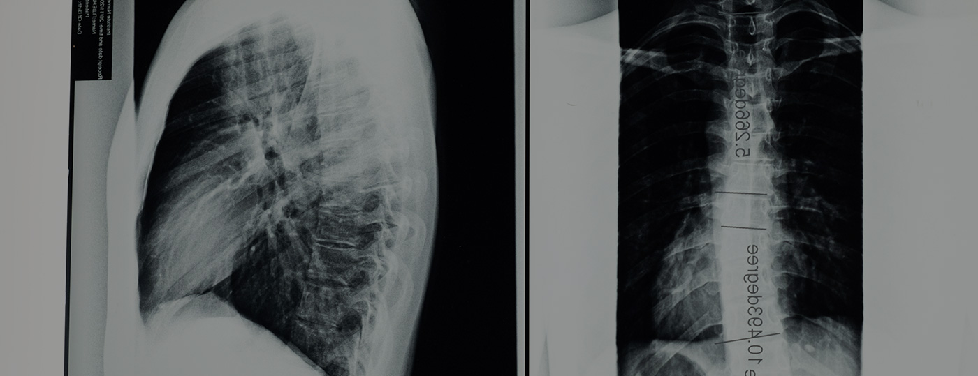 Modulation - Spinologics