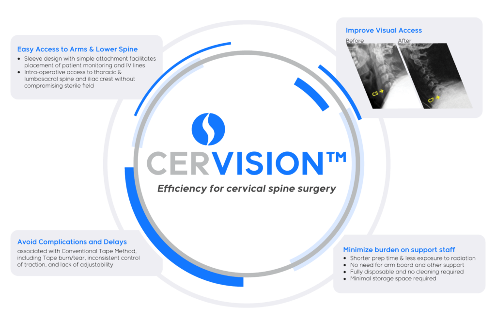 Cervision - Spinologics